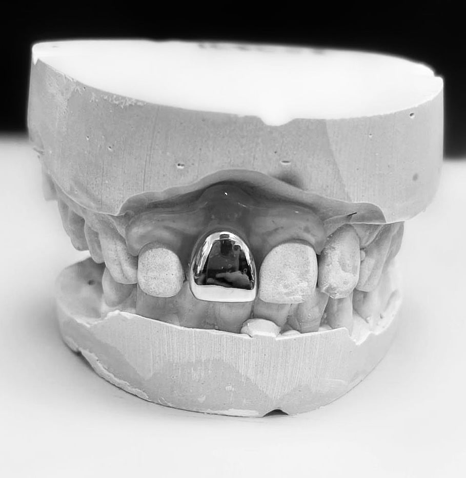 Flexible single tooth Denture deposit – Adore Smile