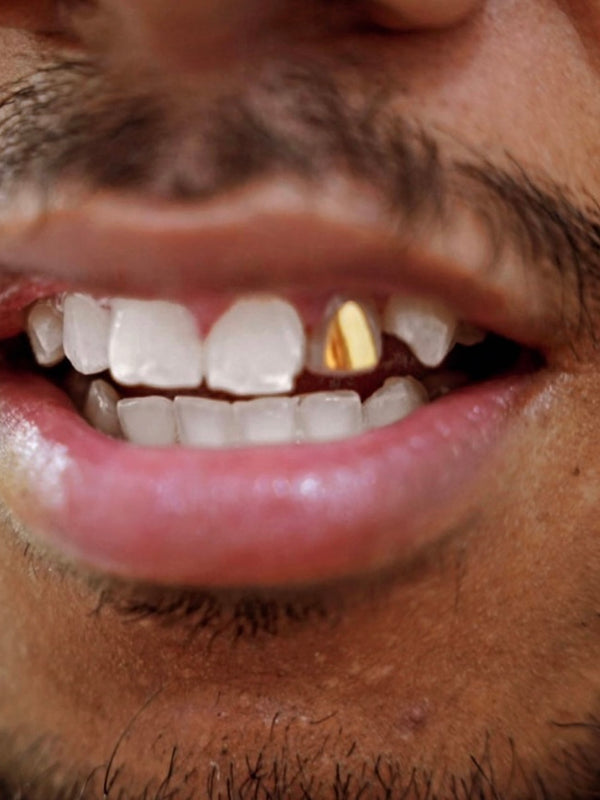 White Gold Tooth Cap gem – Adore Smile